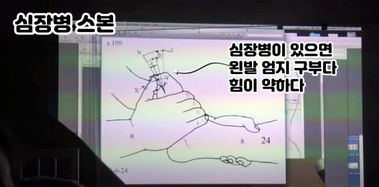 58. 심장 압박감 3, 4년 고통 원인과 KSNS 스본 스도 해결 : 네이버 블로그