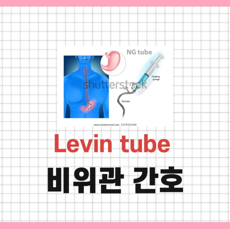 [Nursing skill] 비위관 관리 및 간호 (L-tube, Levin tube, 비위관영양) : 네이버 블로그