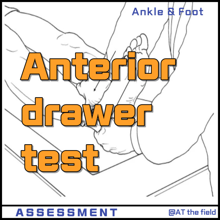 Anterior drawer test / 발목 전방전위 검사/ankle special test/ATFL 손상 검사, 발목 ...