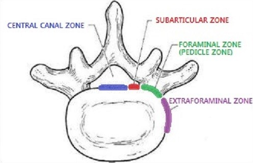 kambin 신경차단술 논문 리뷰 : 네이버 블로그