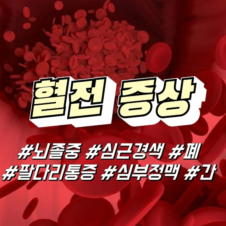 혈전 증상 및 검사 치료 심부정맥 혈전증 다리 혈전용해제 네이버 블로그