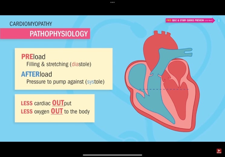 Palpitation 심계항진 및 Preload, Afterload, Stroke volume 심장 영어단어 공부하기 : 네이버 블로그