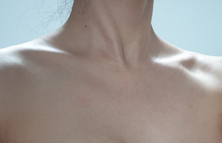 썸블라썸 시카케어 바디미스트 낫포유 바디미스트 버리기 등드름가드름몸드름 타파후기 네이버 블로그