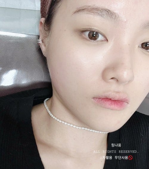 피부과 피부관리 추천 LDM 물방울리프팅 가격,효과,기계 종류 정보 : 네이버 블로그