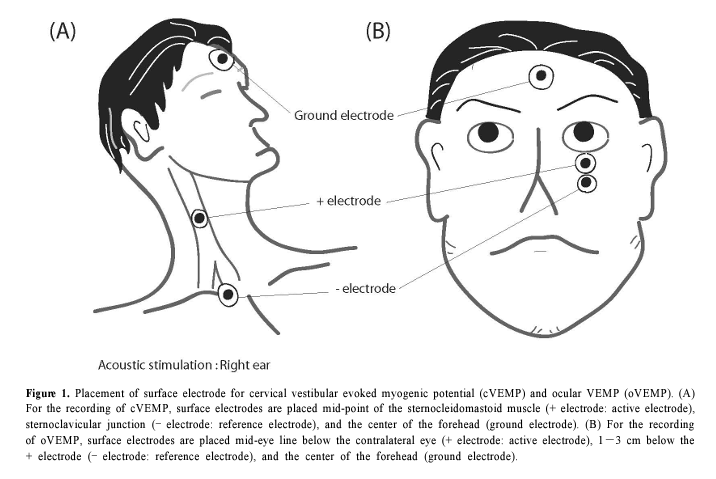전정유발근전위검사(VEMP) : 네이버 블로그