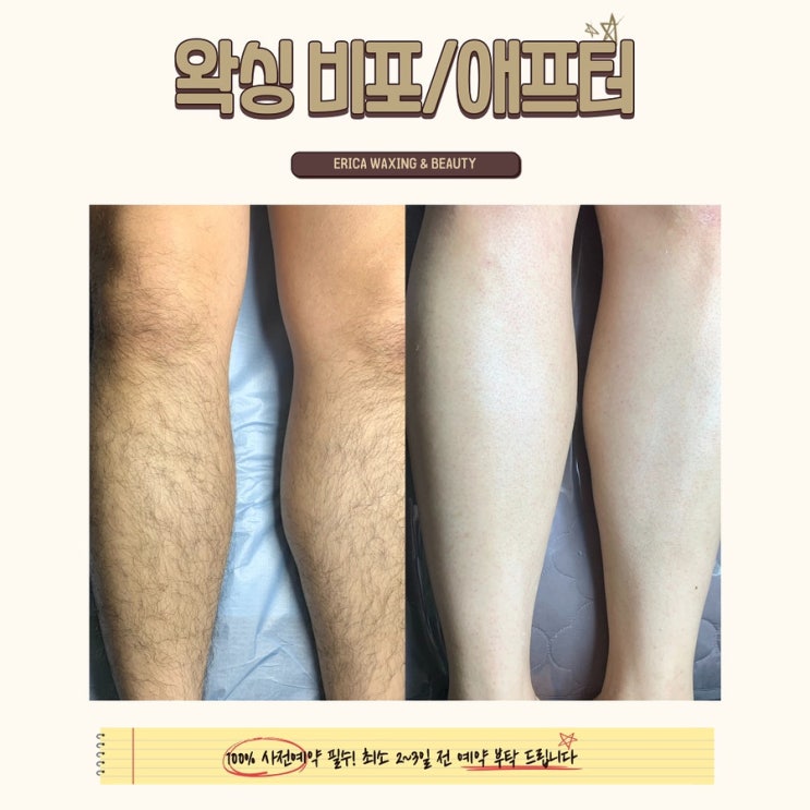 부산왁싱잘하는곳 요이땅~! 8년차왁서한테 안아프게 브라질리언왁싱받기 1+1왁싱할인이벤트♥️ : 네이버 블로그