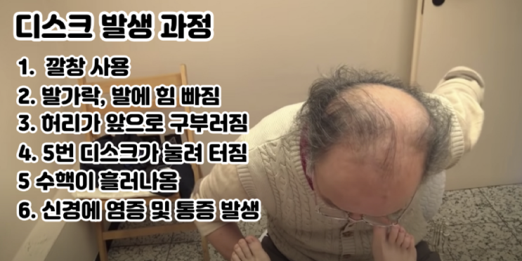 89.척추 협착증 허리 디스크 통증 KSNS 스본 스도 : 네이버 블로그