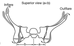 inflare, outflare 확실히하고 가세요 (물리치료사 X-ray보는법까지) : 네이버 블로그