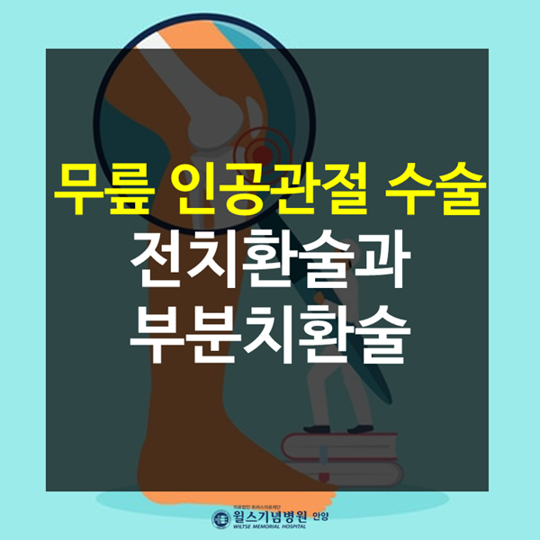 안양정형외과 무릎 인공관절 수술 전치환술과 부분치환술│안양윌스기념병원 네이버 블로그