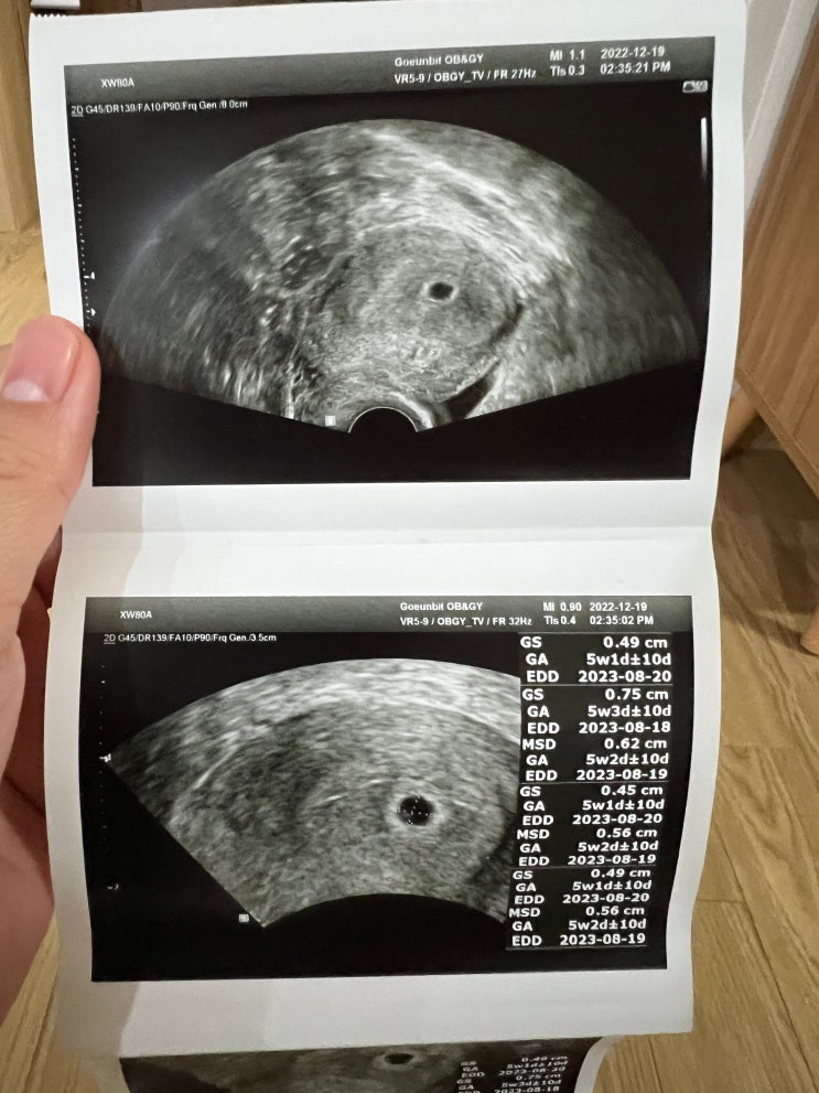임신 5주 일기 강제임밍아웃 And 임테기 역전 후 아가집 확인 5주차 증상 네이버 블로그