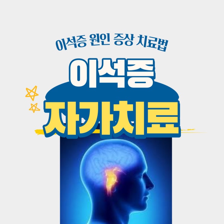 이석증 원인 치료법 자가치료 4가지 알아보자 네이버 블로그