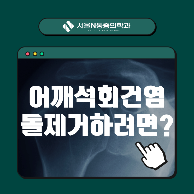 어깨석회건염 어깨에 생긴 돌 제거하려면 네이버 블로그