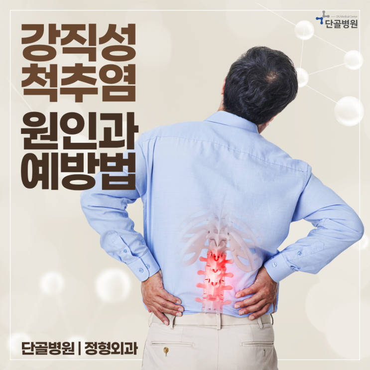 구서동 야간정형외과 금정구 척추 강직성척추염 원인과 예방법 네이버 블로그