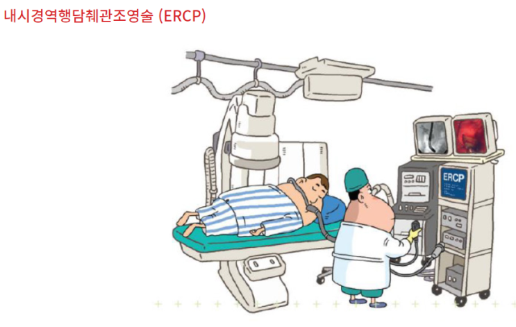 ERCP(endoscopic retrograde cholangiopancreatography, 내시경역행담췌관조영술) : 네이버 블로그