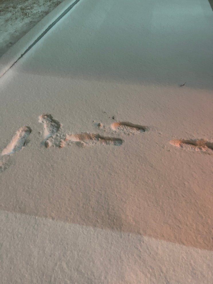 [기록ICL-7]렌즈삽입술 6개월차 검진. : 네이버 블로그