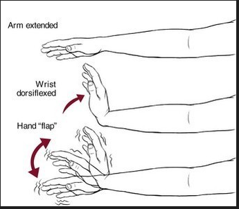 flapping tremor란 무엇일까? : 네이버 블로그