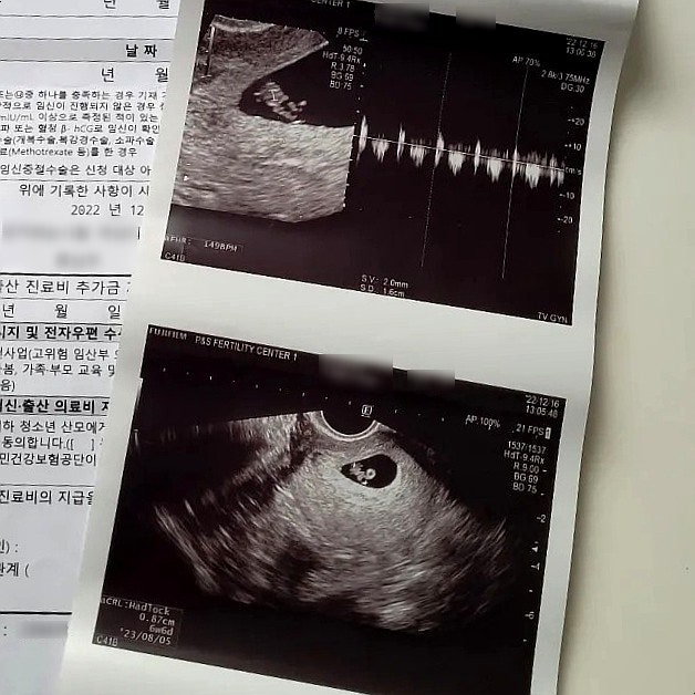 임신 8주차 증상 및 초음파 검사 임신확인서 발급 임산부 등록 임산부 뱃지 네이버 블로그