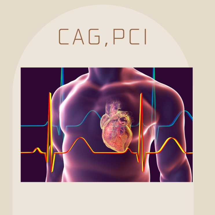CAG 의학용어 PCI 까지 이해하기 쉽도록 : 네이버 블로그