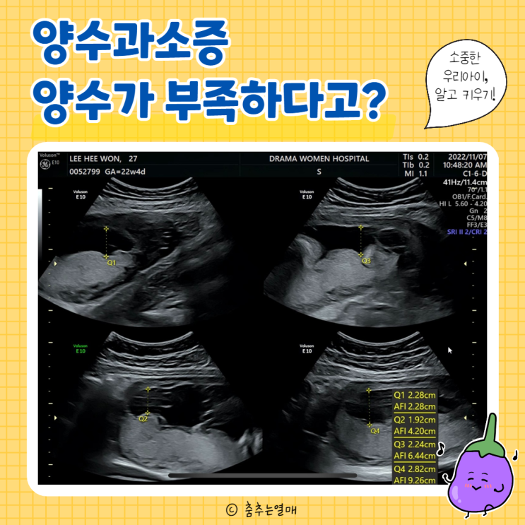 양수과소증 원인 문제점 해결방법까지 양수가 적다면 네이버 블로그