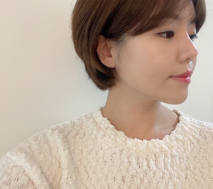 건대피부과 30대 실리프팅 4주 찐 후기 민트실리프팅 네이버 블로그