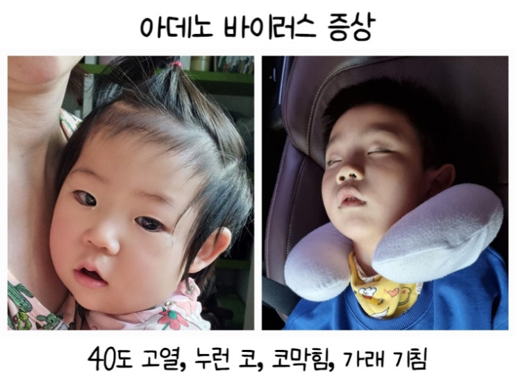 7세 유아 14개월 아기 아데노 바이러스 증상 고열 눈꼽 콧물 기침 일주일 네이버 블로그