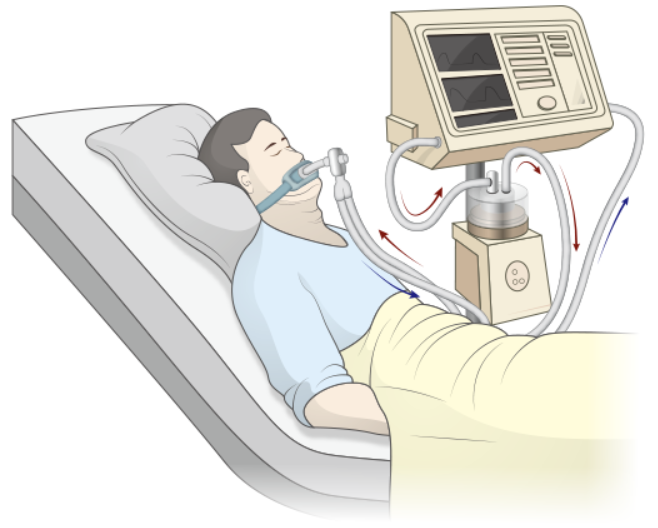 인공환기기 관리(1)/Ventilator Servo-S/특성 및 개요/구조 및 구성/CMV/VCV/PCV/SIMV/PSV ...