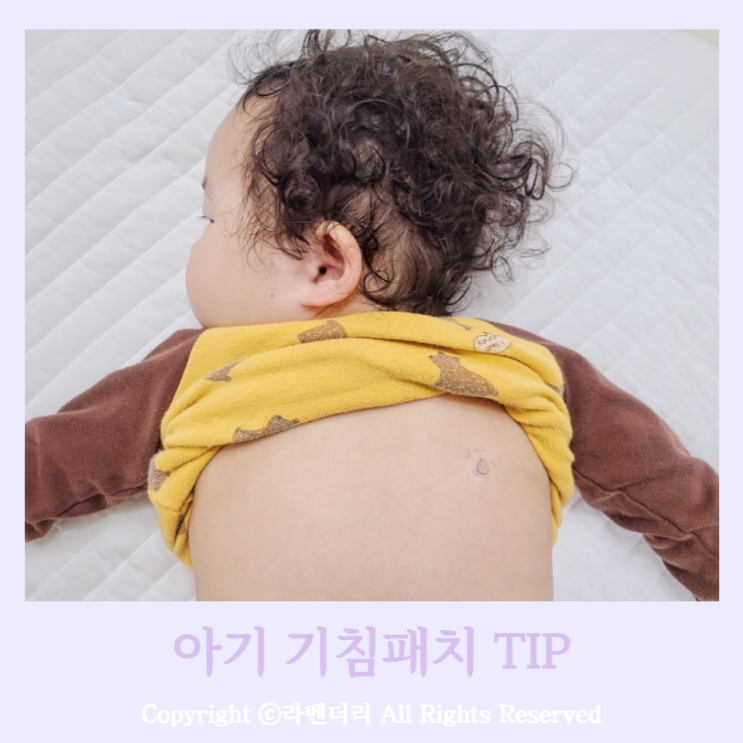 아기 기침 심할때 기침패치 위치 부작용 경험 네이버 블로그