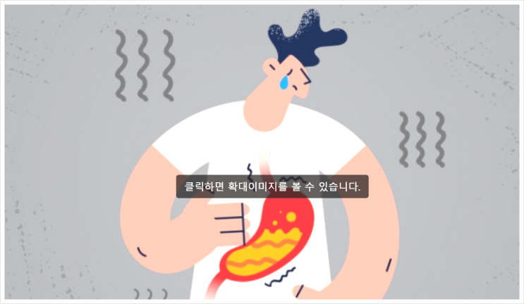 미란성위염 위암되기전에 원인 증상 예방법알아보기 네이버 블로그