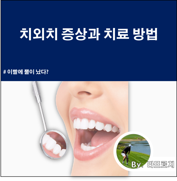 치외치 증상과 치료 방법 네이버 블로그