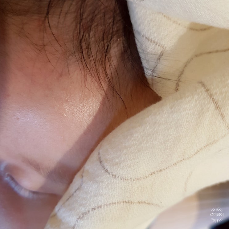 아기두피지루성피부염 머리 각질 신생아 딱지 나만의 팁 네이버 블로그