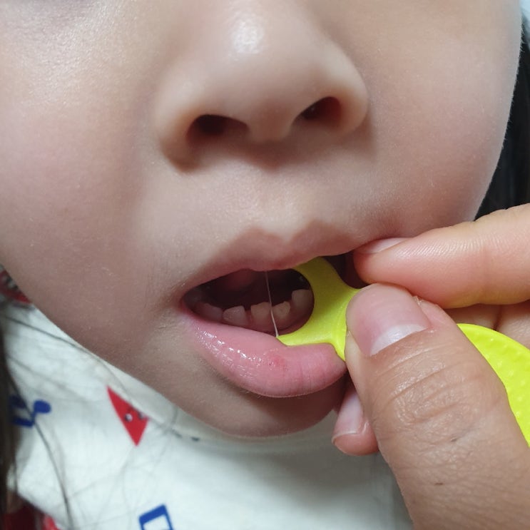 어린이치실 사용시기 플랙커스 대발이치실 유아치실 어렵지 않아요 네이버 블로그
