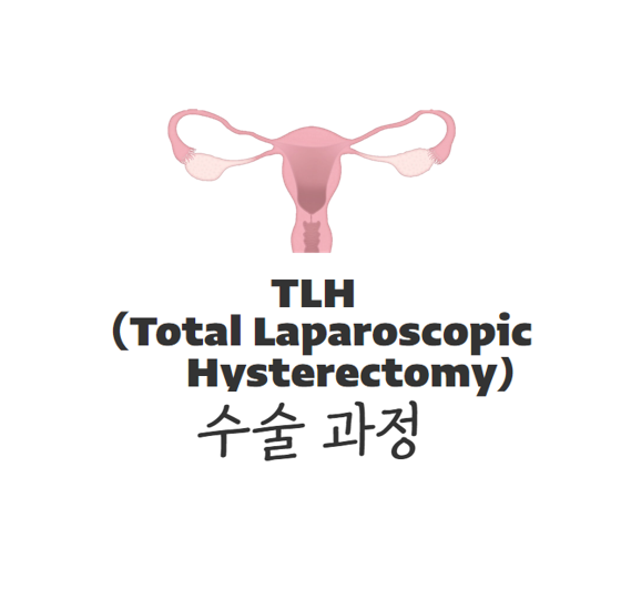 TLH (Total Laparoscopic Hysterectomy) 복강경 자궁 절제술 수술 과정 : 네이버 블로그