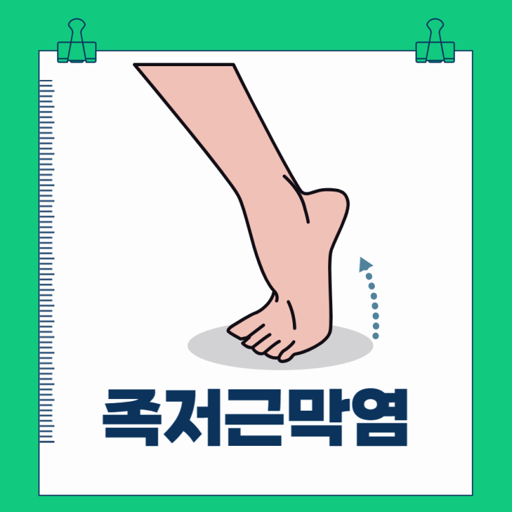 족저근막염 증상 원인 자가치료 치료방법 스트레칭 네이버 블로그