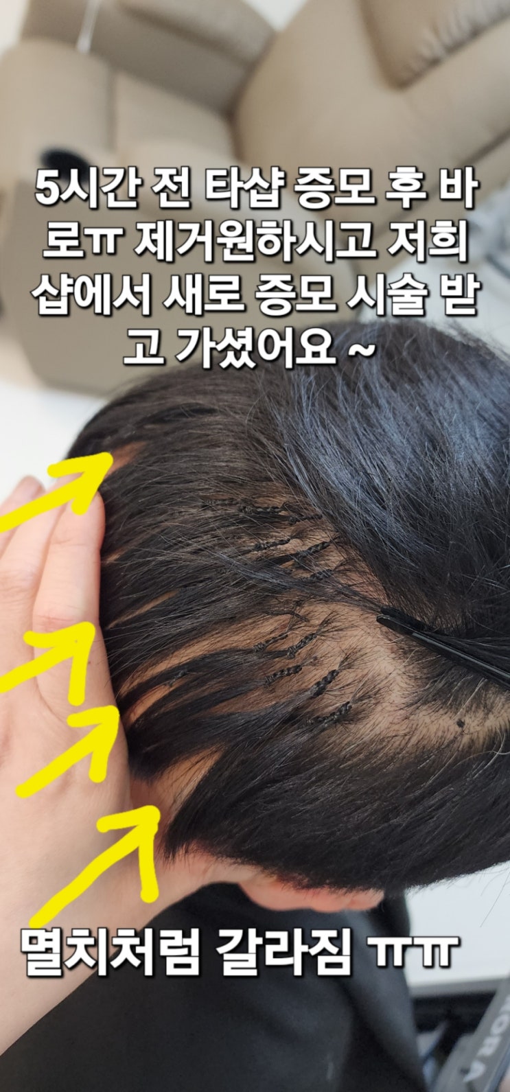 부산 탈모로 고민하는 남자 ! 붙임머리 & 증모로 고민타파 : 네이버 블로그