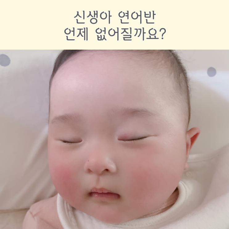 신생아 아기 연어반 언제 없어지나요 생기는 원인 4살 아이 현재 상태 나의경험 네이버 블로그