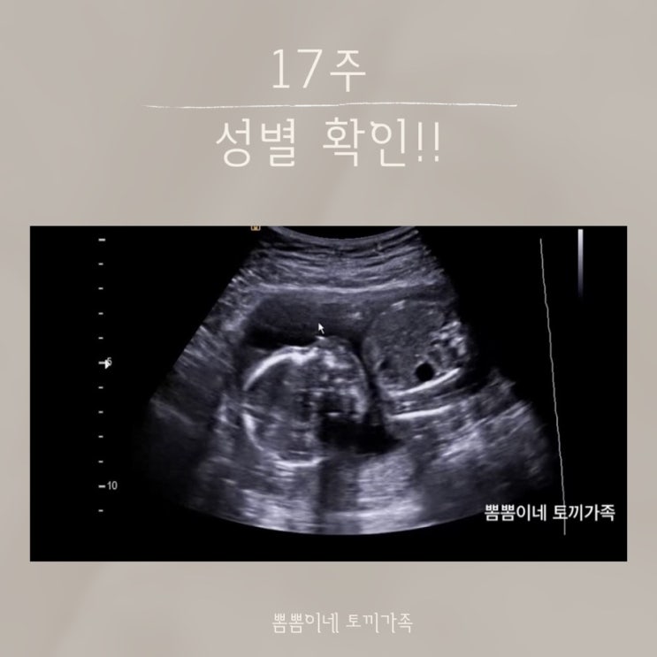 임신17주/성별예측키트 후기(Gender prediction kit,Gender Bliss)/성별확인 : 네이버 블로그