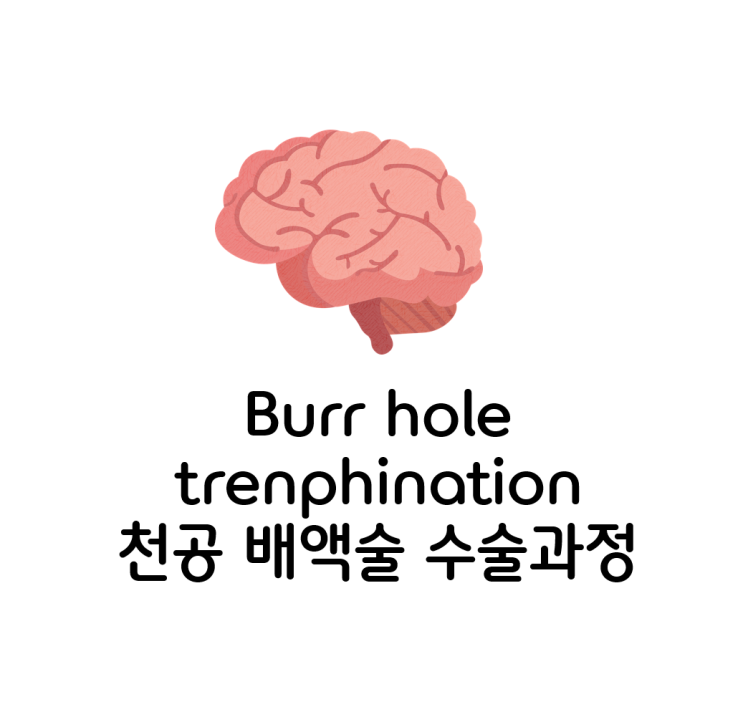 Burr hole trephination(천공배액술) 수술 과정 : 네이버 블로그
