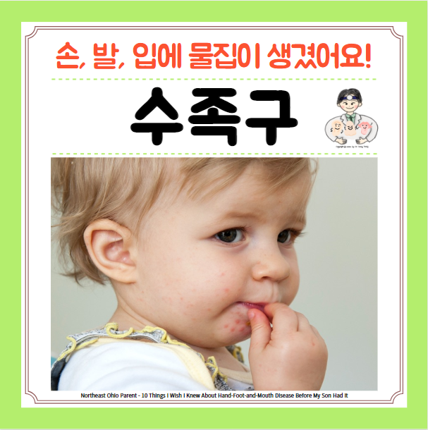 아기 영유아 수족구 수족구병 잠복기 원인 증상 전염 치료 격리 네이버 블로그