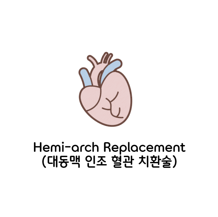 Hemi-arch replacement (대동맥 인조 혈관 치환술) : 네이버 블로그