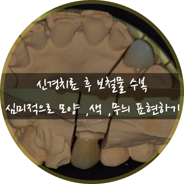 신경치료 후 구강내 심미 보철 감쪽같이 진행하기 네이버 블로그
