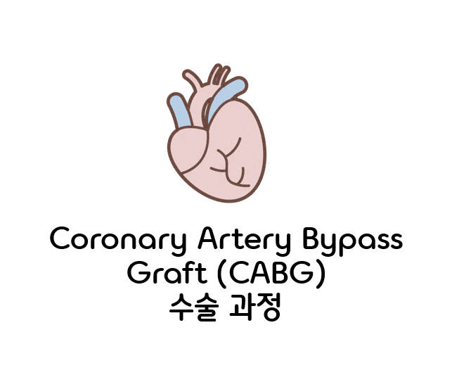CABG (1) Preoperative preparation : 네이버 블로그