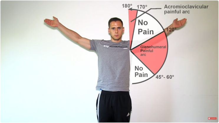 Painful Arc Test (Subacromial Impingemet Exam) : 네이버 블로그