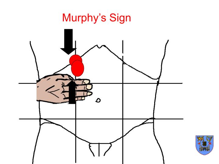 전주 송천동 목디스크 운동재활센터, 머피사인(Murphy Sign), 급성 담낭염 이학적 검사 : 네이버 블로그