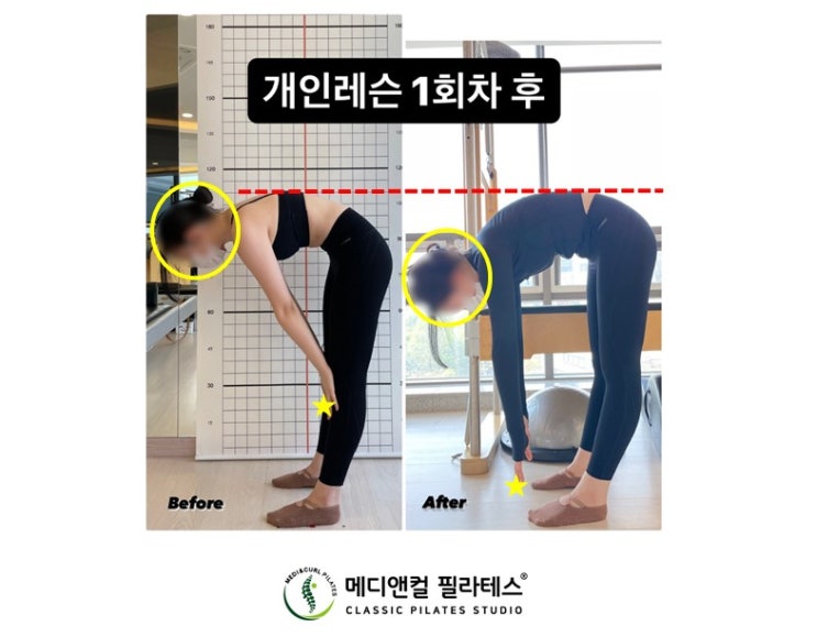 사직동 필라테스 1:1개인레슨 추천, 메디앤컬 사직점에서 받으세요! : 네이버 블로그