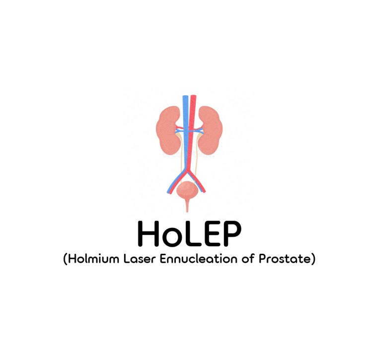 Holmium Laser Ennucleation of Prostate (HoLEP) : 네이버 블로그