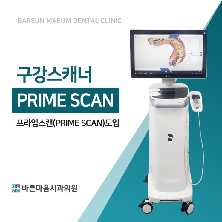 바른마음치과의원, 구강스캐너 PRIME SCAN 도입! : 네이버 블로그
