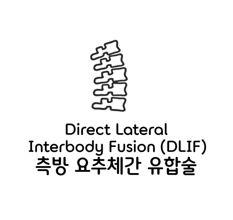 DLIF (Direct Lateral Interbody Fusion) 측방 요추체간 유합술 수술 기구 및 세팅 : 네이버 블로그