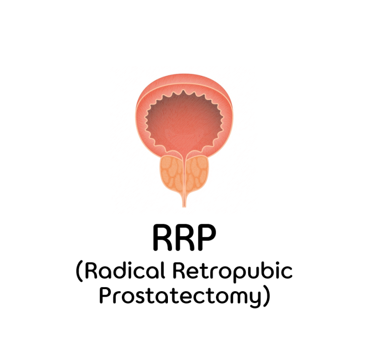 RRP (Retrograde Retropubic Prostatectomy) : 네이버 블로그