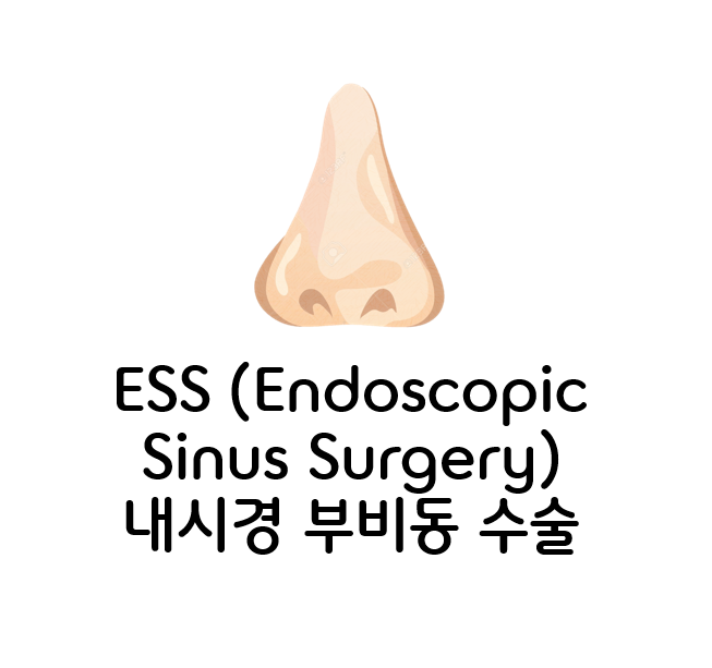 ESS (Endoscopic Sinus Surgery) 내시경 부비동 수술 : 네이버 블로그