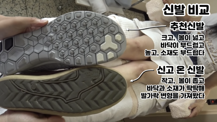 303. 좁은 신발로 발생하는 수많은 질병 KSNS KSS 스본 스도로 해결 : 네이버 블로그